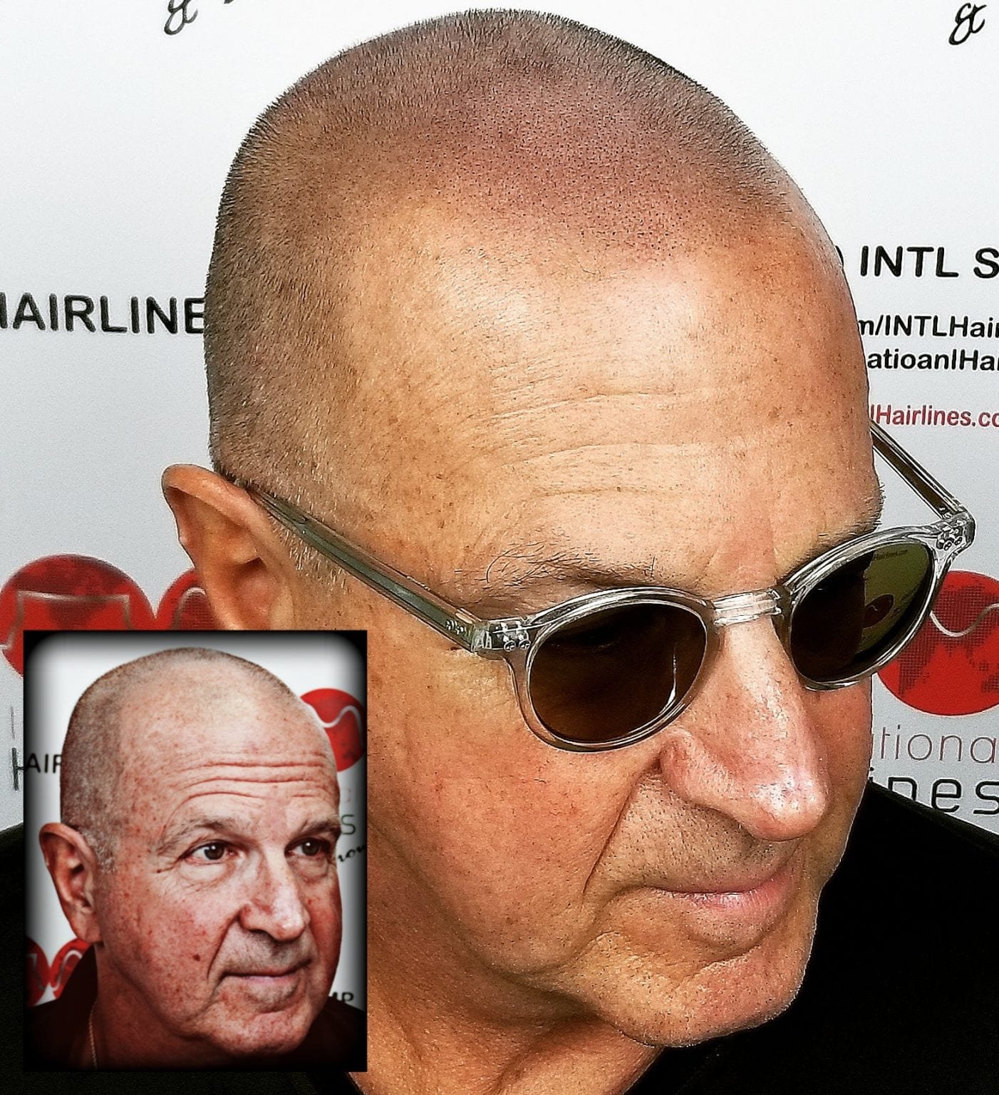 Pompano Beach, FL | International Hairlines