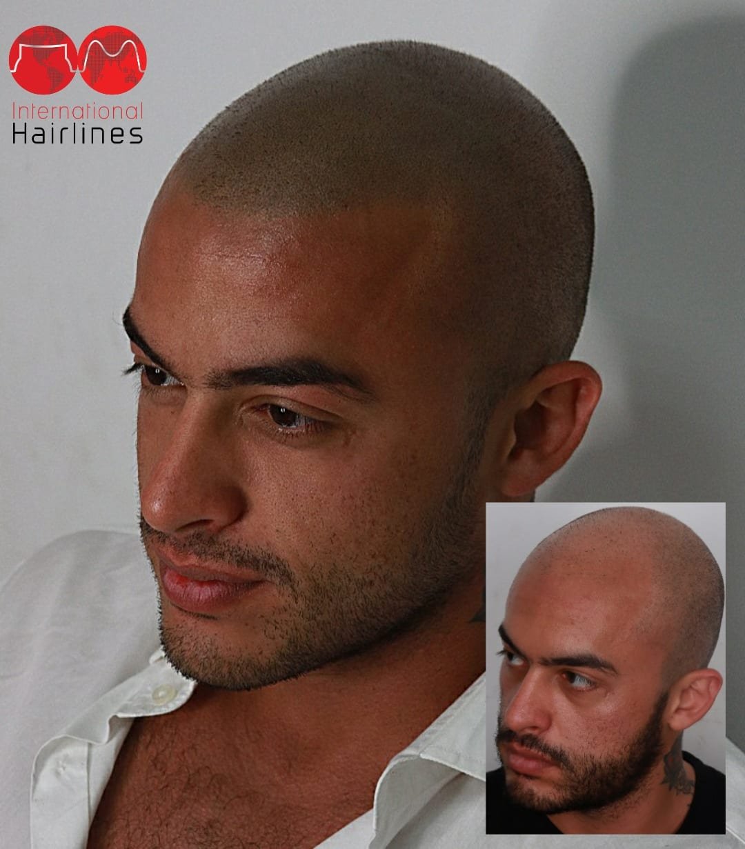 SMP Landing Miami | International Hairlines